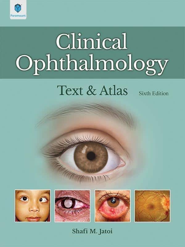 Jatoi Ophthalmology - Clinical Ophthalmology: Text And Atlas, 6th ...